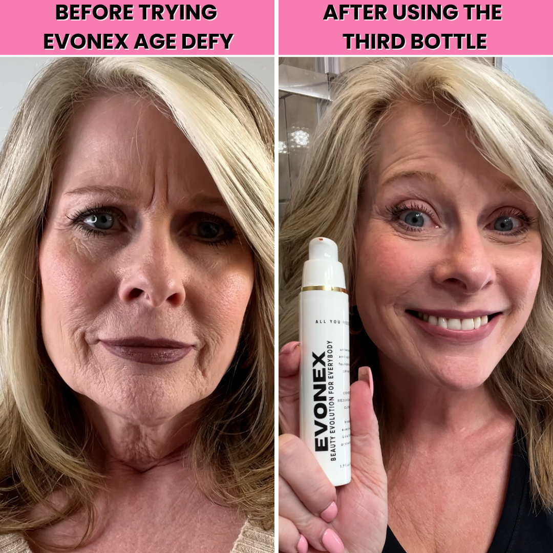 7 REASONS WHY – Evonex®